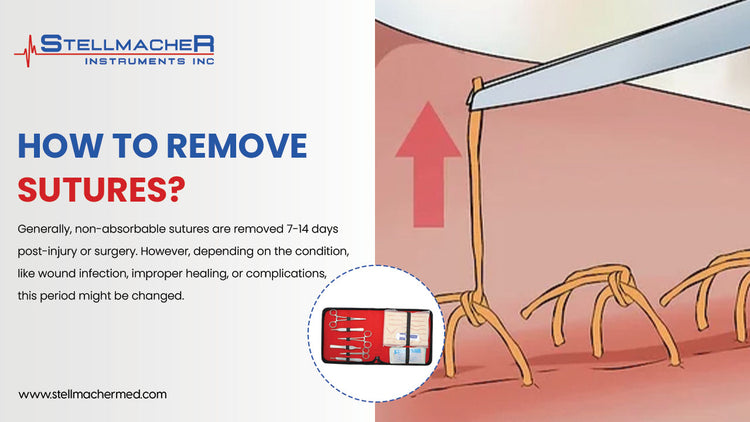 How to Remove Sutures?